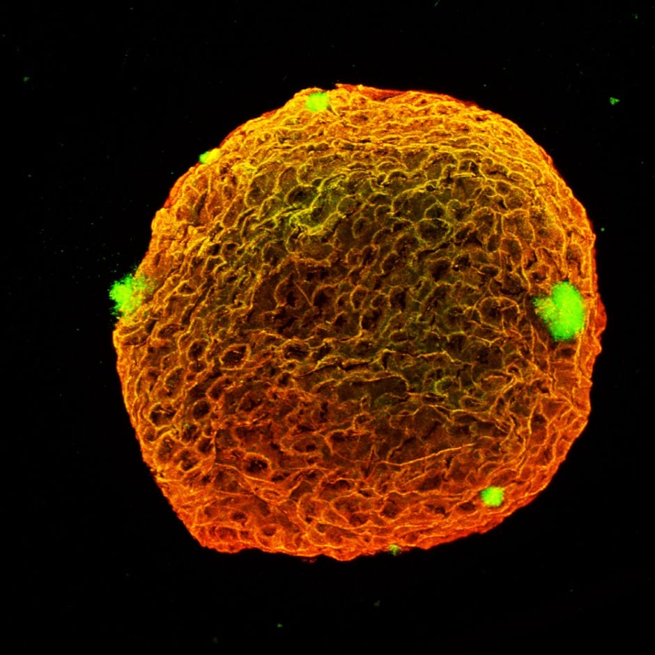 La preuve par l'image 2013 | ICI Explora